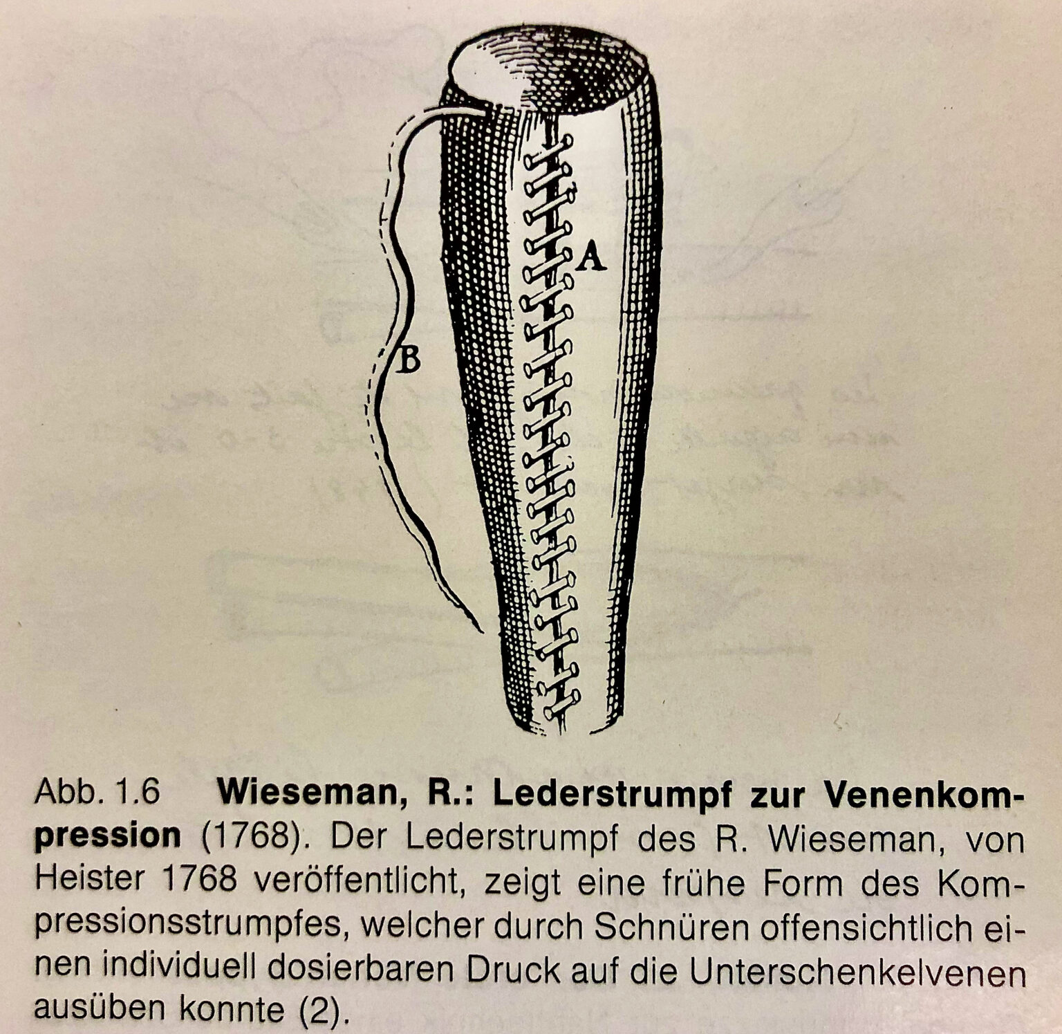 Saphenion®: 115 Jahre Endovenöse Krampfadertherapie